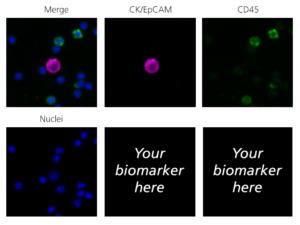 RarePlex CTC Detection with Developer Kits | Rarecyte