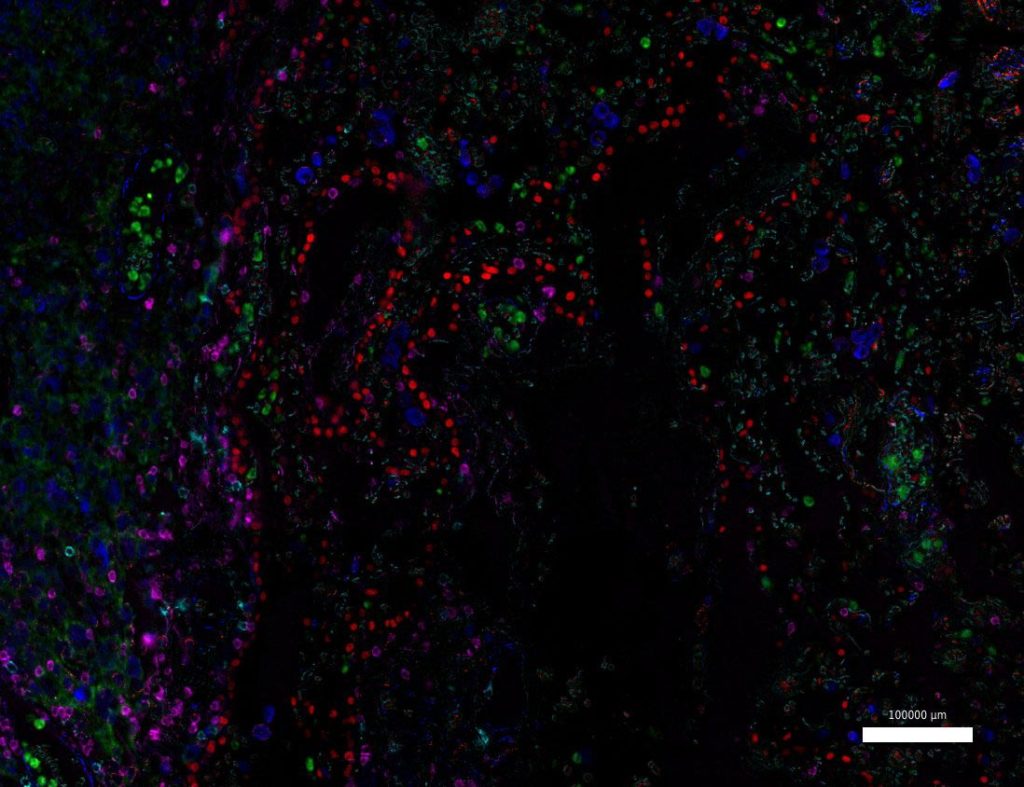 Spatial Biology Applications for Rapid Tissue Analysis | Rarecyte