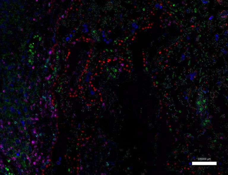 Orion Applications » RareCyte