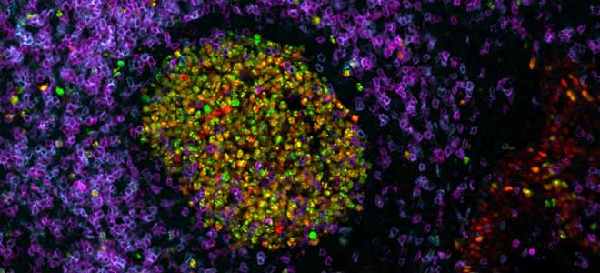 Orion: Whole slide multiplexed imaging for Spatial Biology | RareCyte