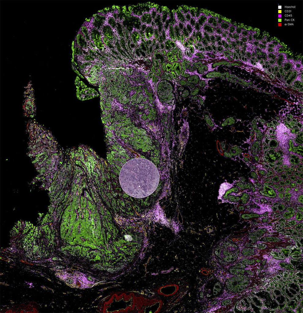 Orion: Whole slide multiplexed imaging for Spatial Biology | RareCyte