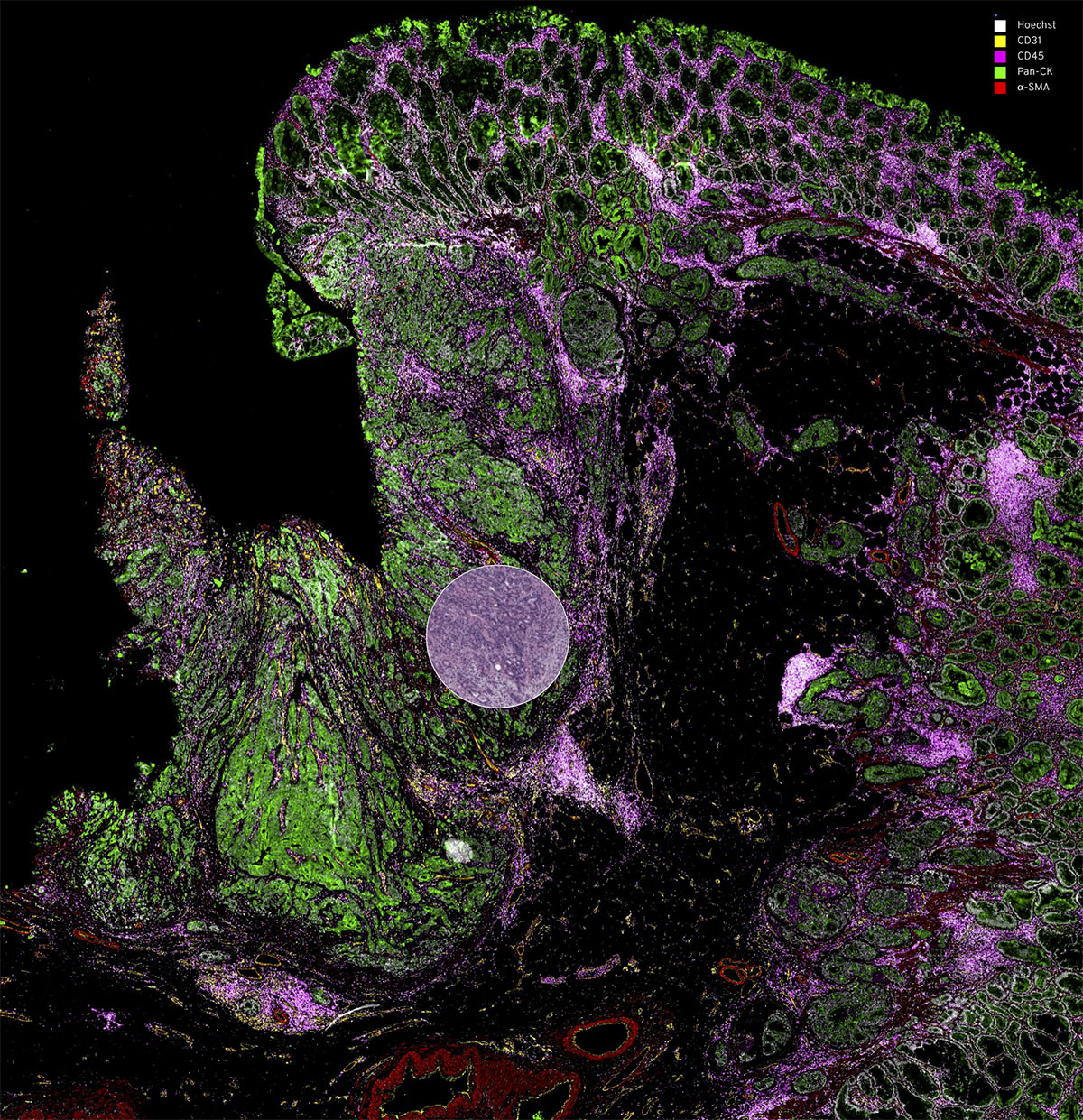 Orion: Whole slide multiplexed imaging for Spatial Biology | RareCyte