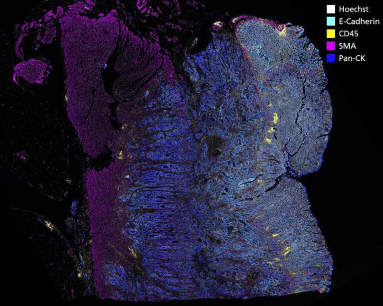 Advanced Multiplex Staining with Orion Reagents | Rarecyte