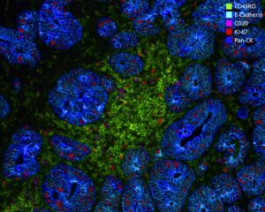 Advanced Multiplex Staining with Orion Reagents | Rarecyte