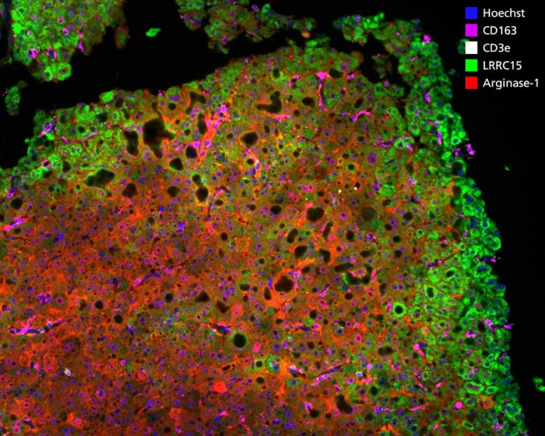 Advanced Multiplex Staining with Orion Reagents | Rarecyte
