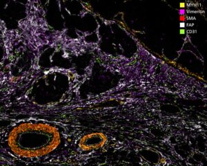Spatial Biology Applications for Rapid Tissue Analysis | Rarecyte