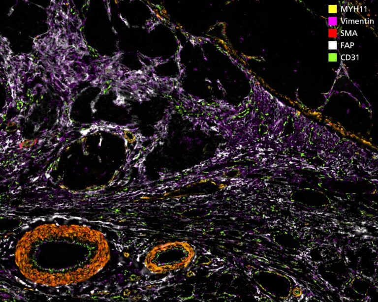 Spatial Biology Applications for Rapid Tissue Analysis | Rarecyte