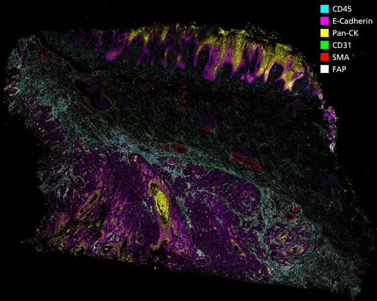 Spatial Biology Applications for Rapid Tissue Analysis | Rarecyte
