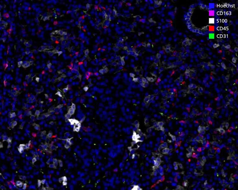 Advanced Multiplex Staining with Orion Reagents | Rarecyte