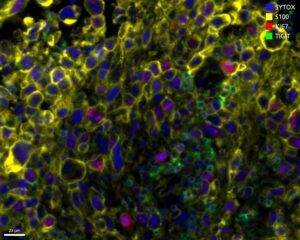 Advanced Multiplex Staining with Orion Reagents | Rarecyte