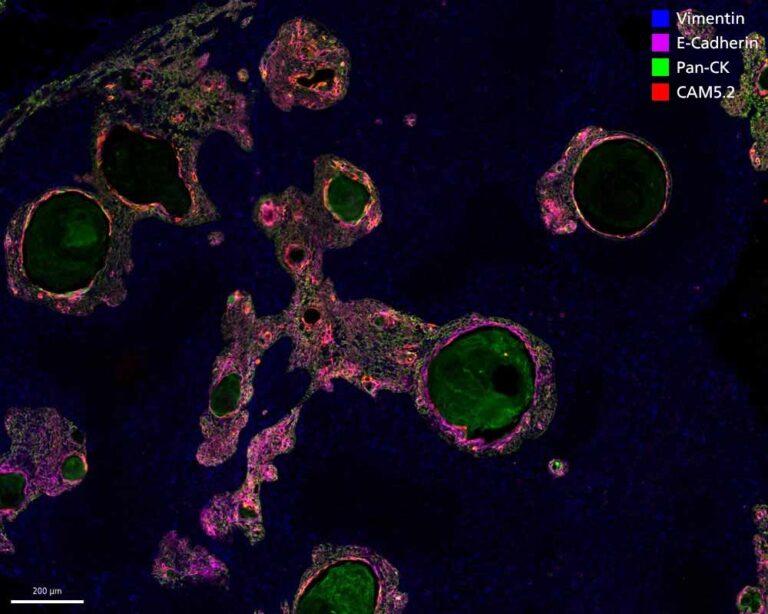 Advanced Multiplex Staining with Orion Reagents | Rarecyte