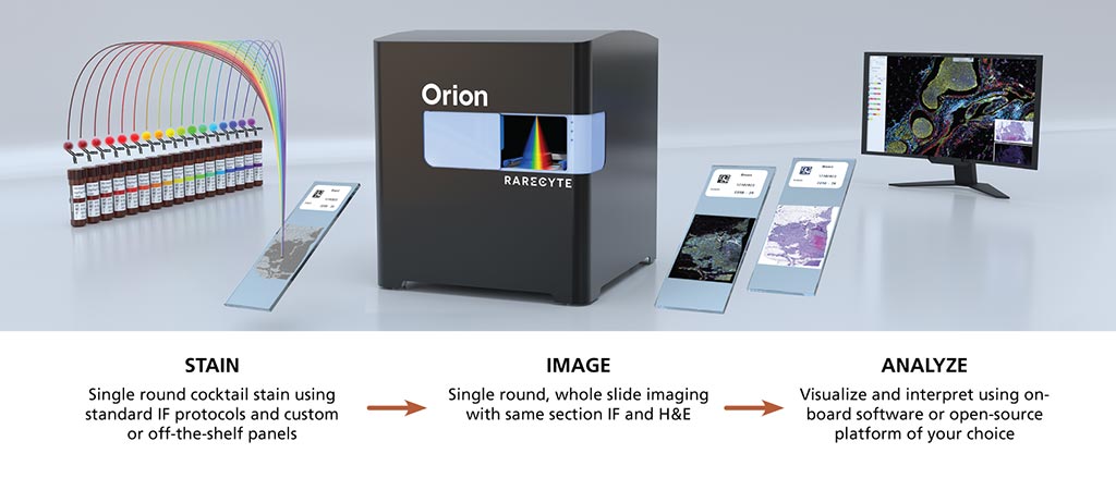 Orion: Whole slide multiplexed imaging for Spatial Biology | RareCyte