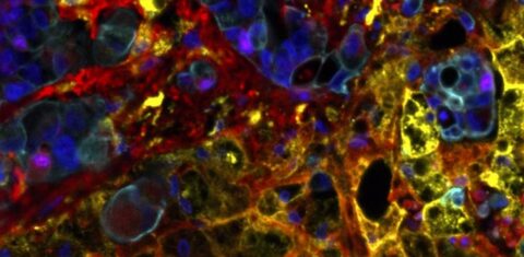 Orion: Whole slide multiplexed imaging for Spatial Biology | RareCyte