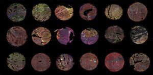 Orion: Whole slide multiplexed imaging for Spatial Biology | RareCyte